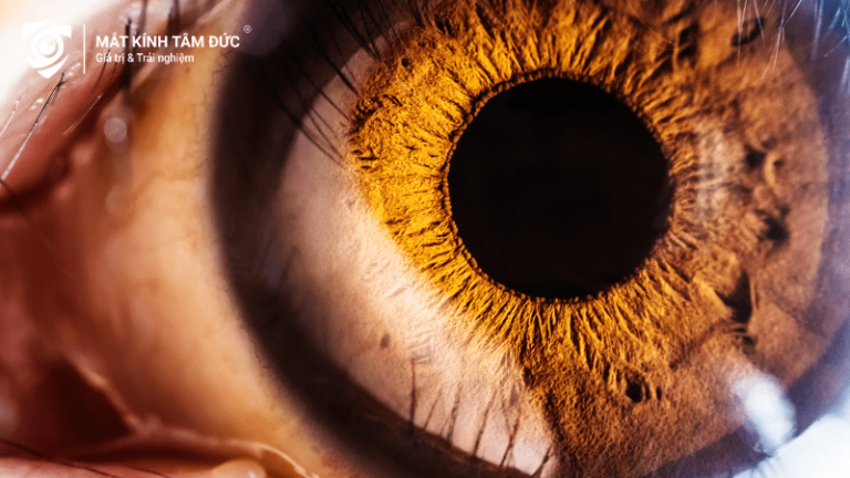 Mắt nâu nói lên điều gì? Sự thật ý nghĩa về đôi mắt màu nâu